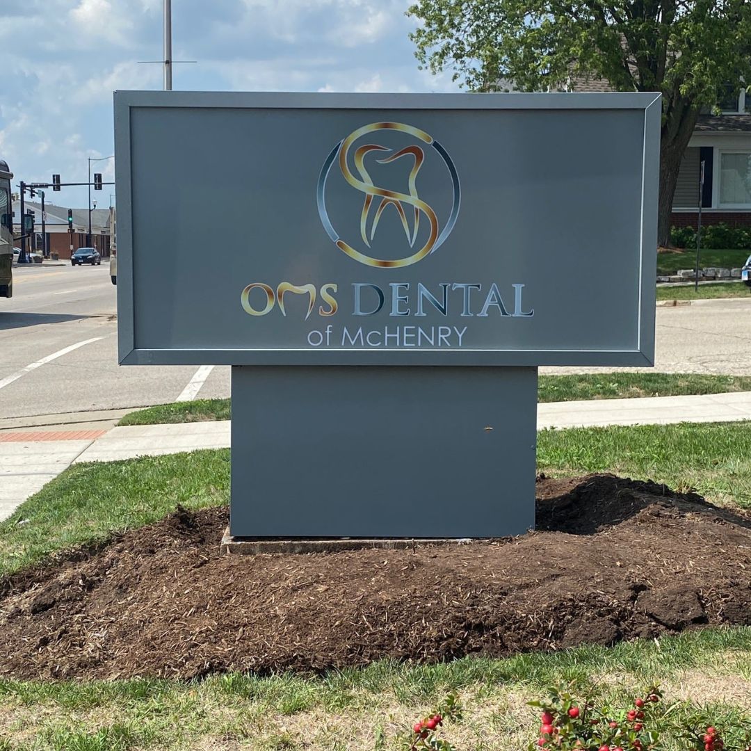 Illuminated vs. Non-Illuminated Monument Signs